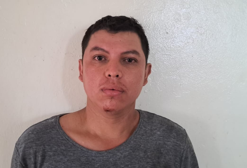 Hombre que embistió a motociclista en Santa Ana conducía bajo efectos ...